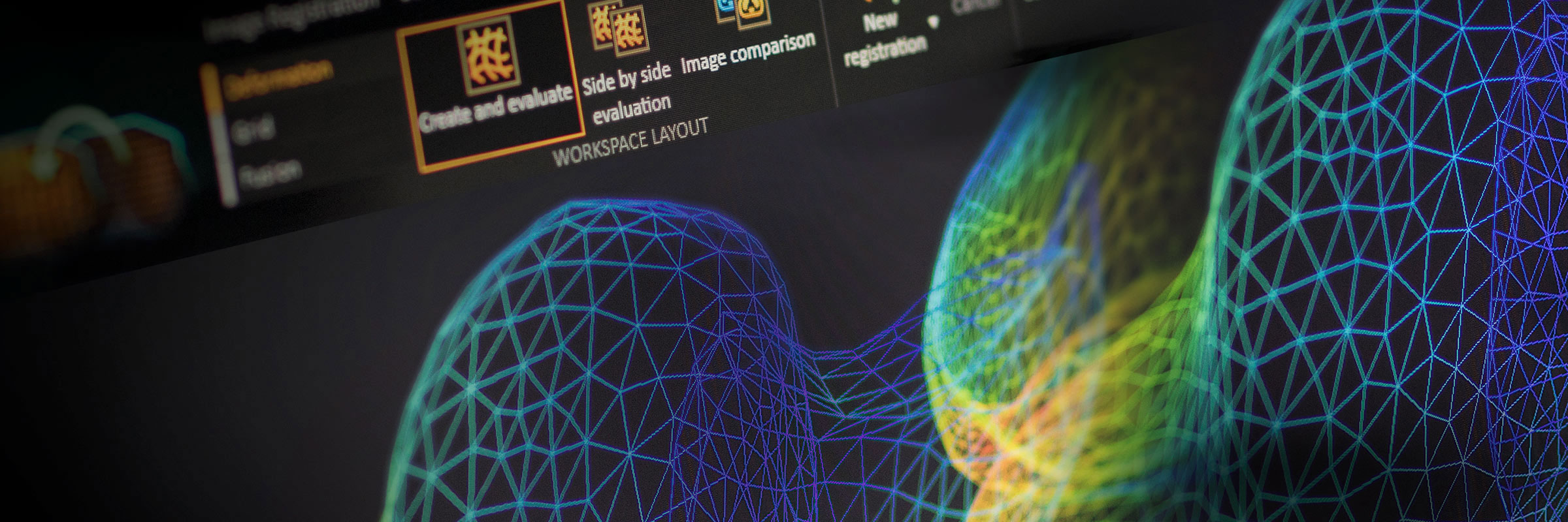 Adaptive Radiotherapy (ART) - Αναστασία Στεργιούλα, MD